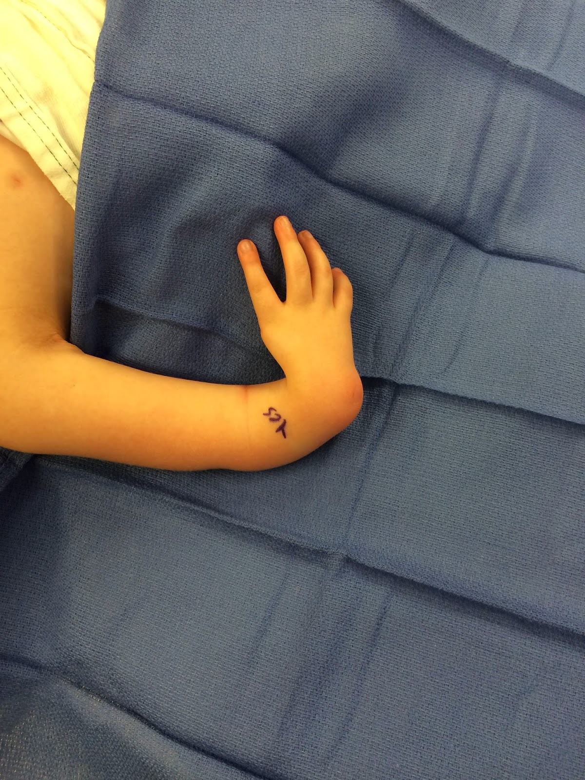 Radial Deficiency- Every Child is Unique | Congenital Hand and Arm ...