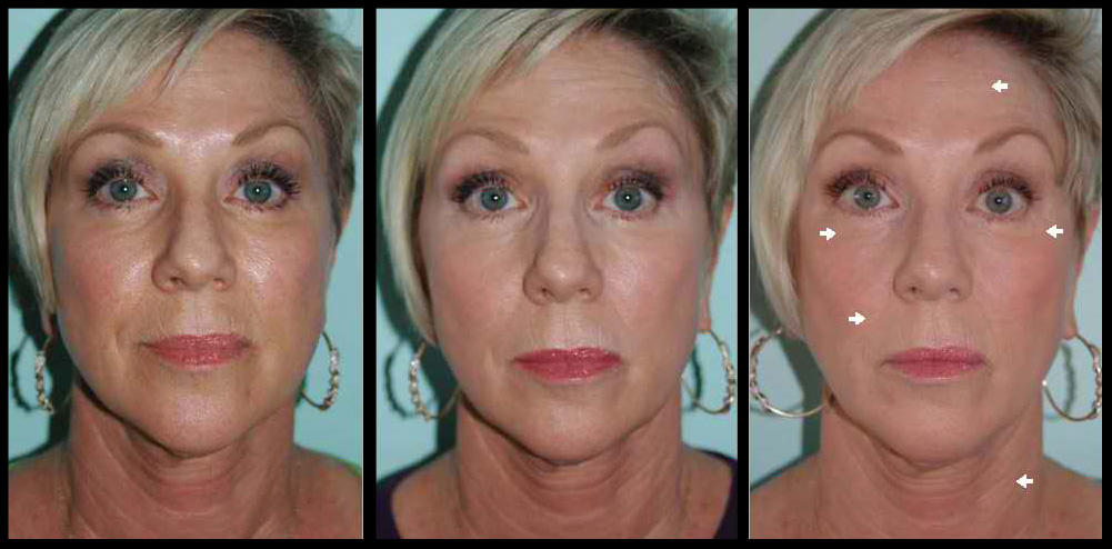 ageLOC Technology - The Future of Anti-aging: RESULTS: AgeLOC Galvanic Spa