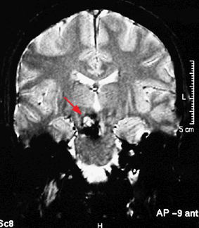 Case of the Day: Popcorn