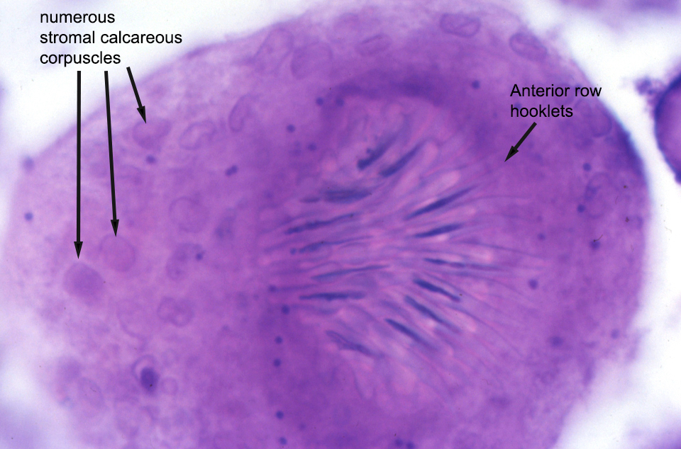 Creepy Dreadful Wonderful Parasites: Answer to Case 367