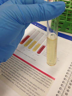 Microbiology Mania: Nitrate Reduction Test {Lab 8 - May 21, 2015}