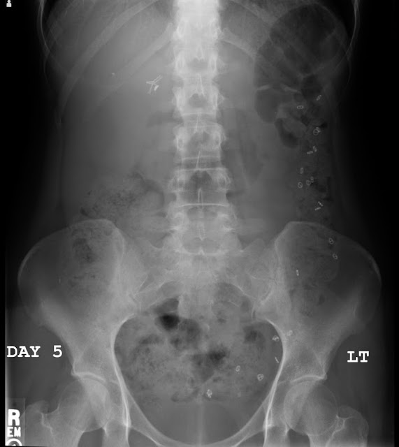 Blogged Up Body - Blogged Up Life : Radiology