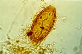Mikrobiologi dan Parasitologi Dian Husada: HUBUNGAN PARASIT dan INANG