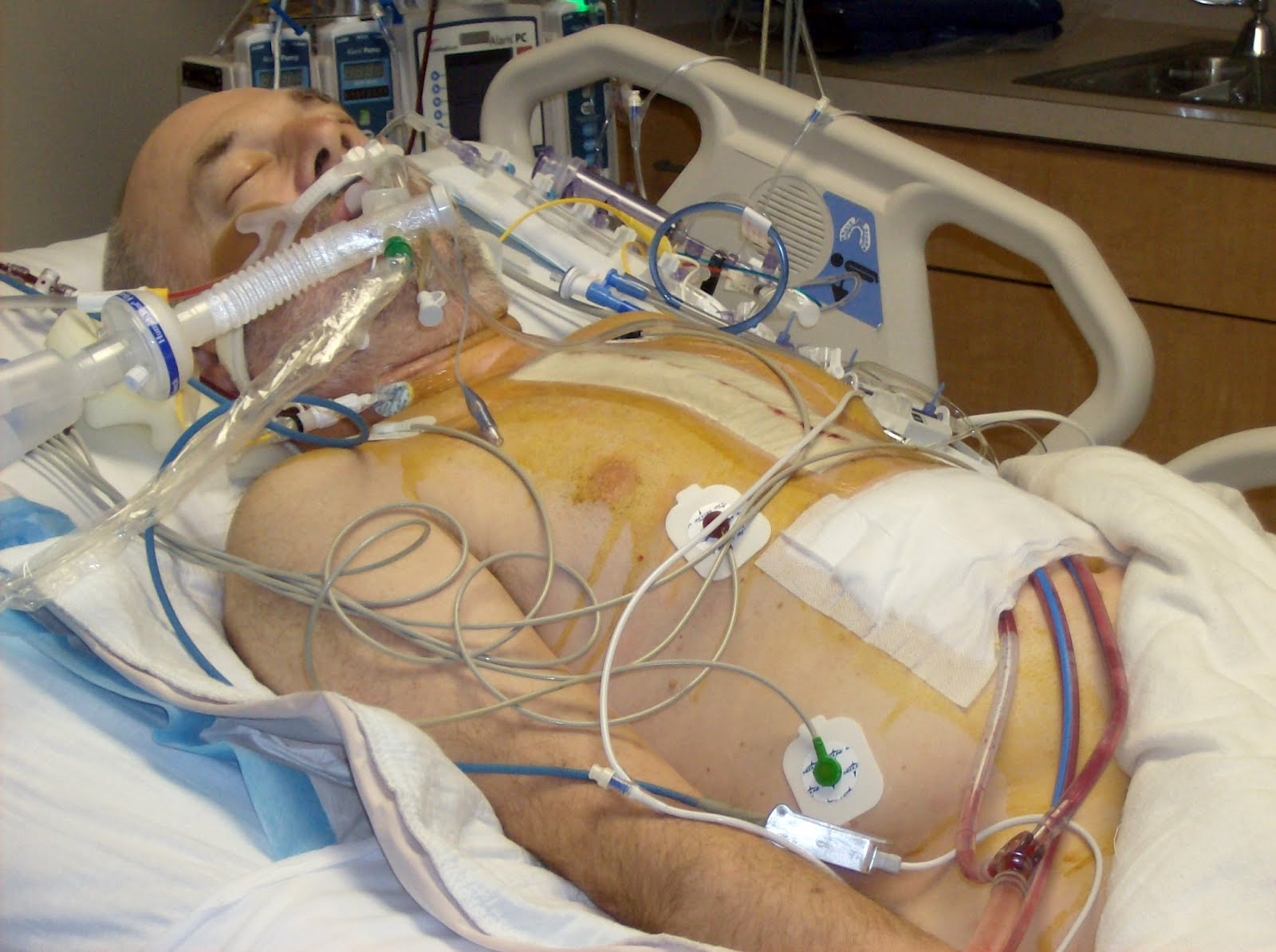 Lacunae Musing: Labels