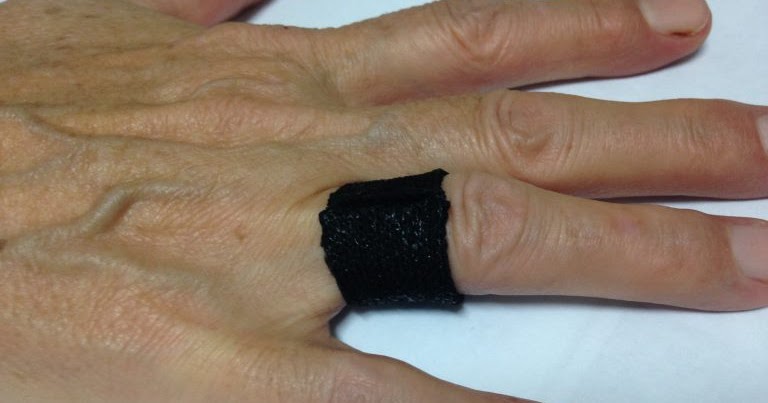 Discapacidad y salud: Dedo gatillo o resorte - terapias