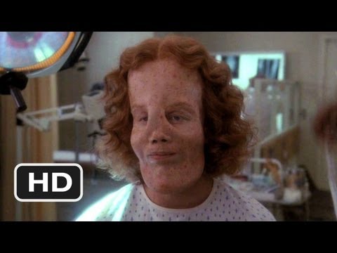 JANE ENTRE LINHAS: Roy Lee "Rocky" Dennis