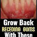 Grow Back Your Receding Gums With These Natural Remedies ! | Health Pins