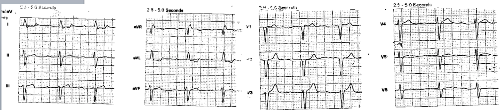 Lvh with ivcd - slickvirt