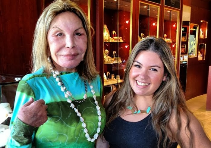 Elsa Patton:The Worst Example Of Plastic Surgery Disaster (28 Pics ...