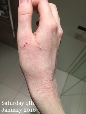 Hand-some | TSW Cara