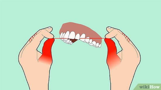 10 pasos para usar hilo dental ~ Clínica U.P.L.A.