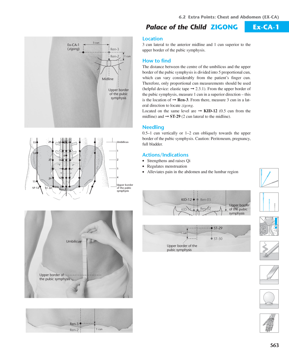 Acupuncture Masters: Acupuncture Points Database - Extra Points