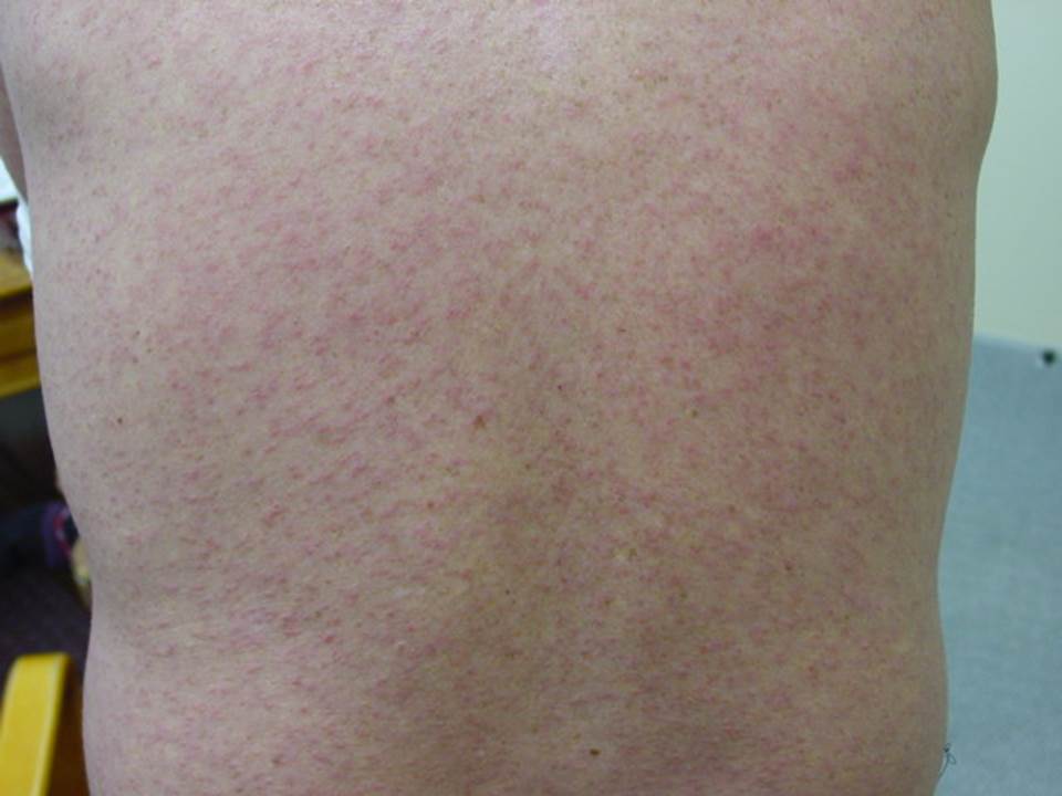Teaching Dermatology Specialist Trainee Edition: Red Non Scaly Diseases