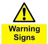 My Body Signs: Knobby Knuckles