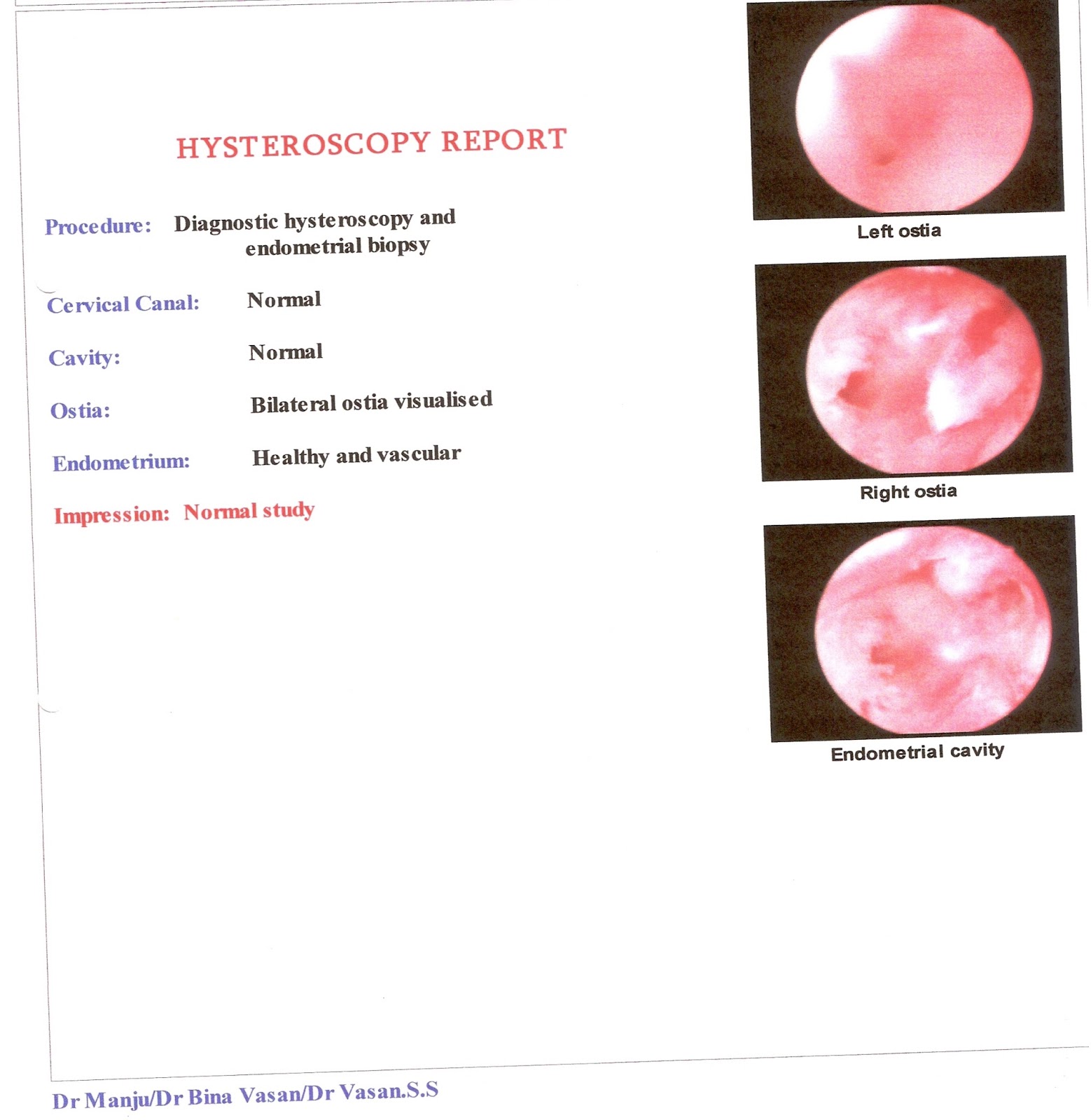 IVF IUI ICSI ART My Hysteroscopy Report ivf-iui-icsi-art-my-hysteroscopy-report