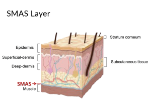 NaBella Clinic By NaBell: แนะนำ!!! ร้อยไหม SMAS LOCK คืออะไร ดีอย่างไร???
