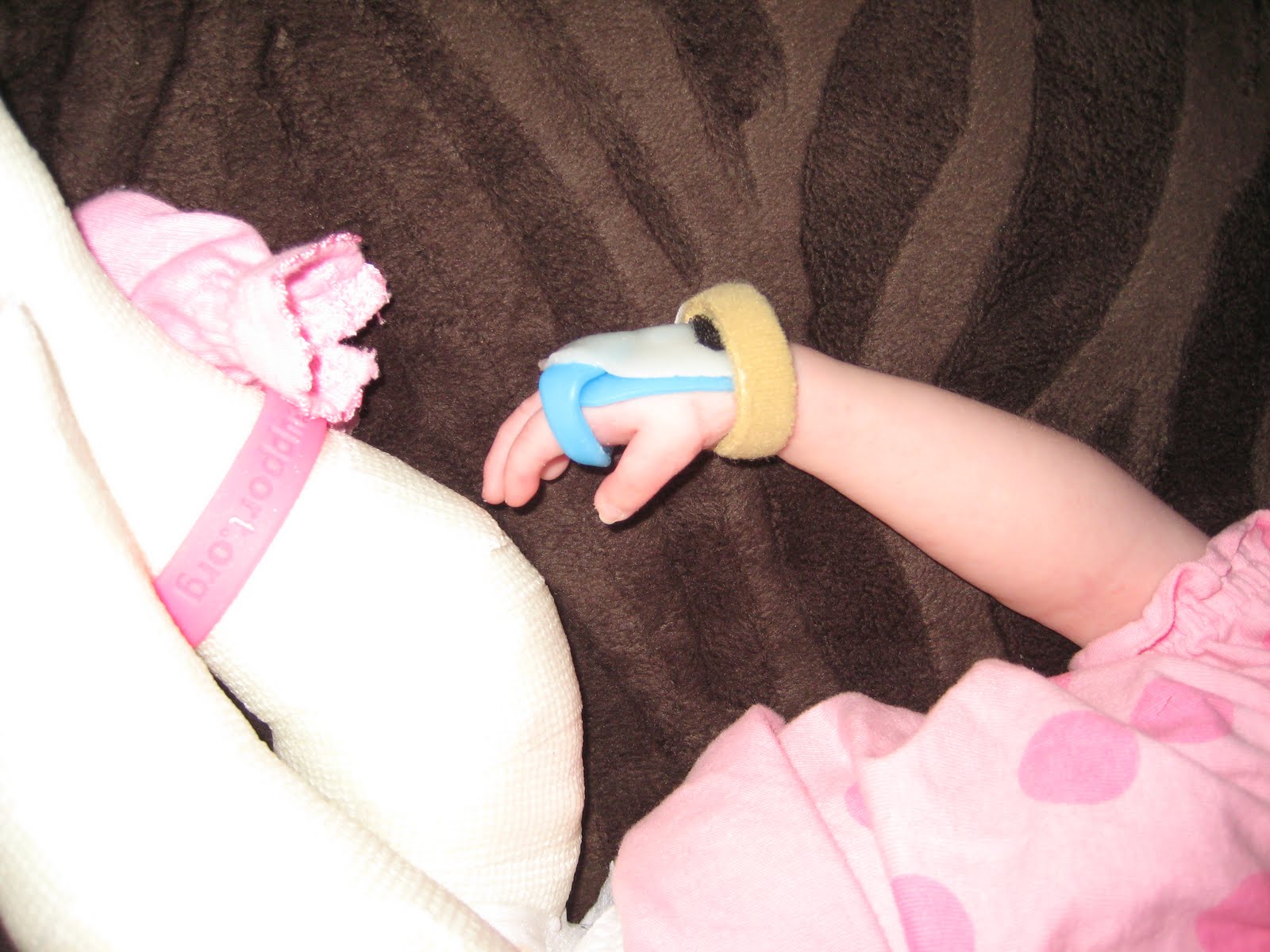 Sweet Analise Rose's Journey with Arthrogryposis, Amyoplasia type: Day ...