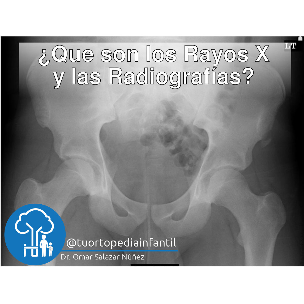 ¿Que son los Rx y las radiografías?