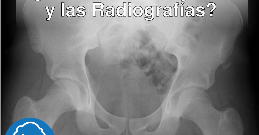¿Que son los Rx y las radiografías?