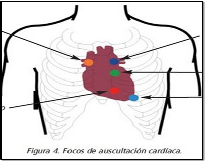 Casi-Paramédico: Focos o ruidos cardíacos
