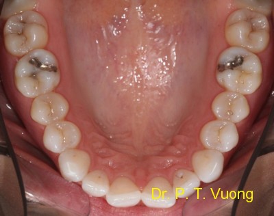 Dr. Phuoc Vuong Dentist - Phuoc T. Vuong, DMD, MS - Dr. Phil T. Vuong ...