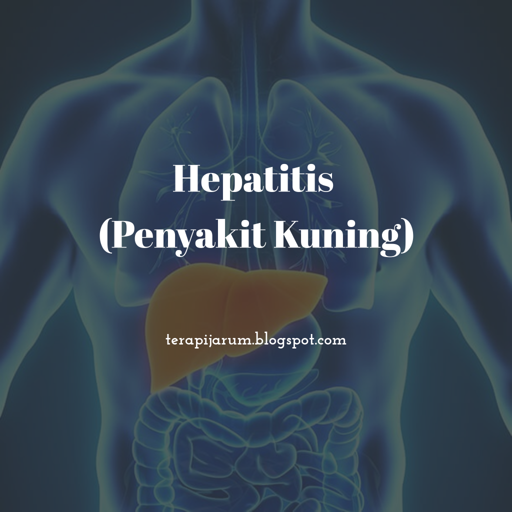 Titik Akupunktur Hepatitis (Penyakit Kuning) - Terapi Jarum
