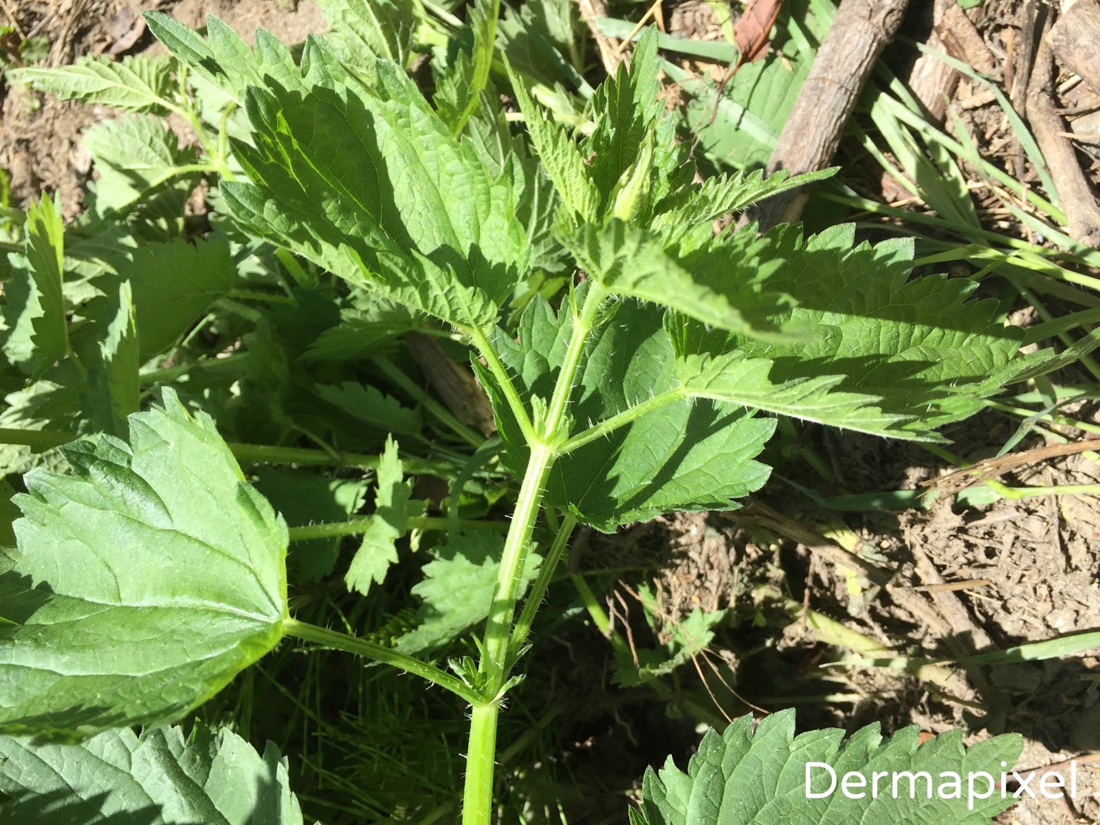 Dermapixel: Cuando te pica una ortiga