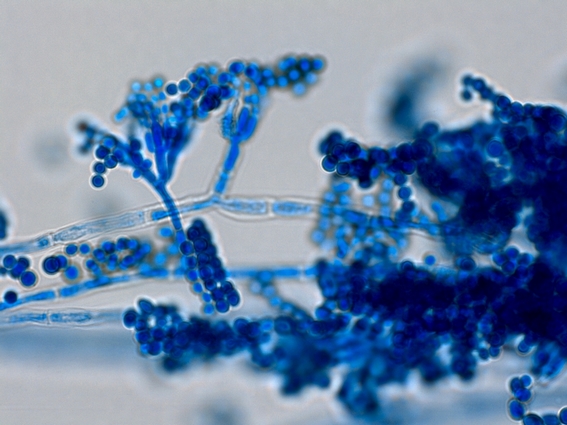 Fun With Microbiology (What's Buggin' You?): Penicillium species