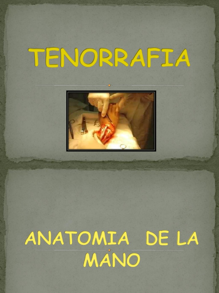 tenorrafia - wood scribd braxin