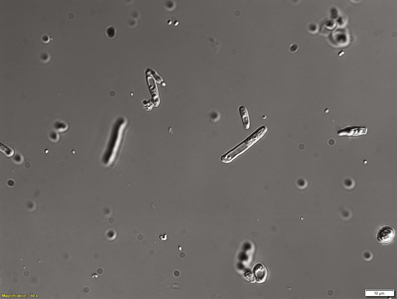 Kilned Brewing: Oude Bruin (Roeselare) Microscopy