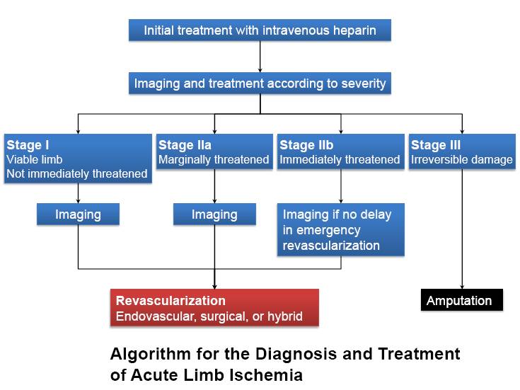 Vascular Mind : ALGORITHM FOR MANAGEMENT OF ACUTE LOWER LIMB ISCHEMIA ...