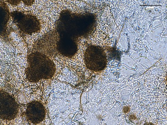 Phoma - Alchetron, The Free Social Encyclopedia