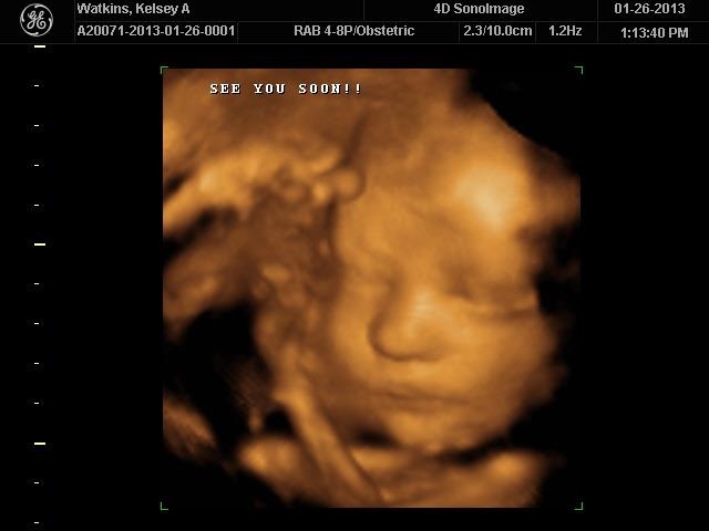 Hello, Bebe Watkins!: 4D Ultrasound | 31 Weeks