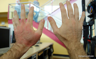 thompsound blog: burning...