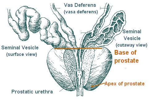 BPH (BENIGNA PROSTATE HYPERPLASIA/ HYPERTRIPY) ~ Blog Artikel Kesehatan