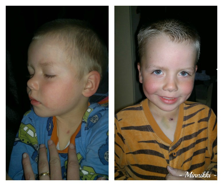 Minnikin elämää: Puh pah pelistä Pois - hyvästi fisteli