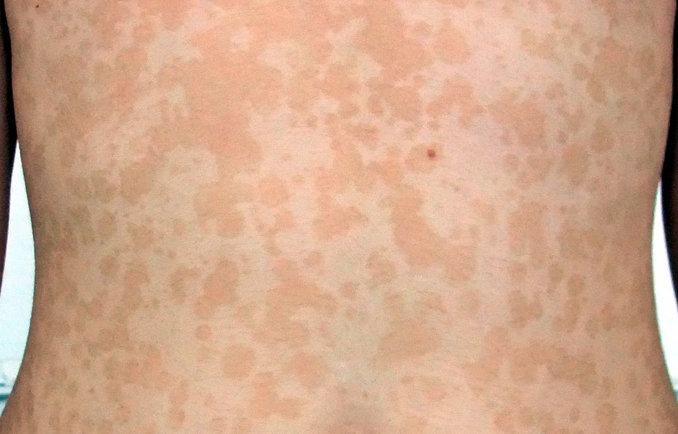 DERMATOLOGIA APROAPE DE TINE CABINET DERMATOLOGIE IASI DERMATOLOG ...