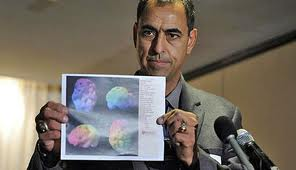 Concussions in Pro Sports: The Case of George Visger