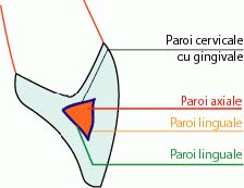 school of dentistry: Topographical classification cavities decay and ...