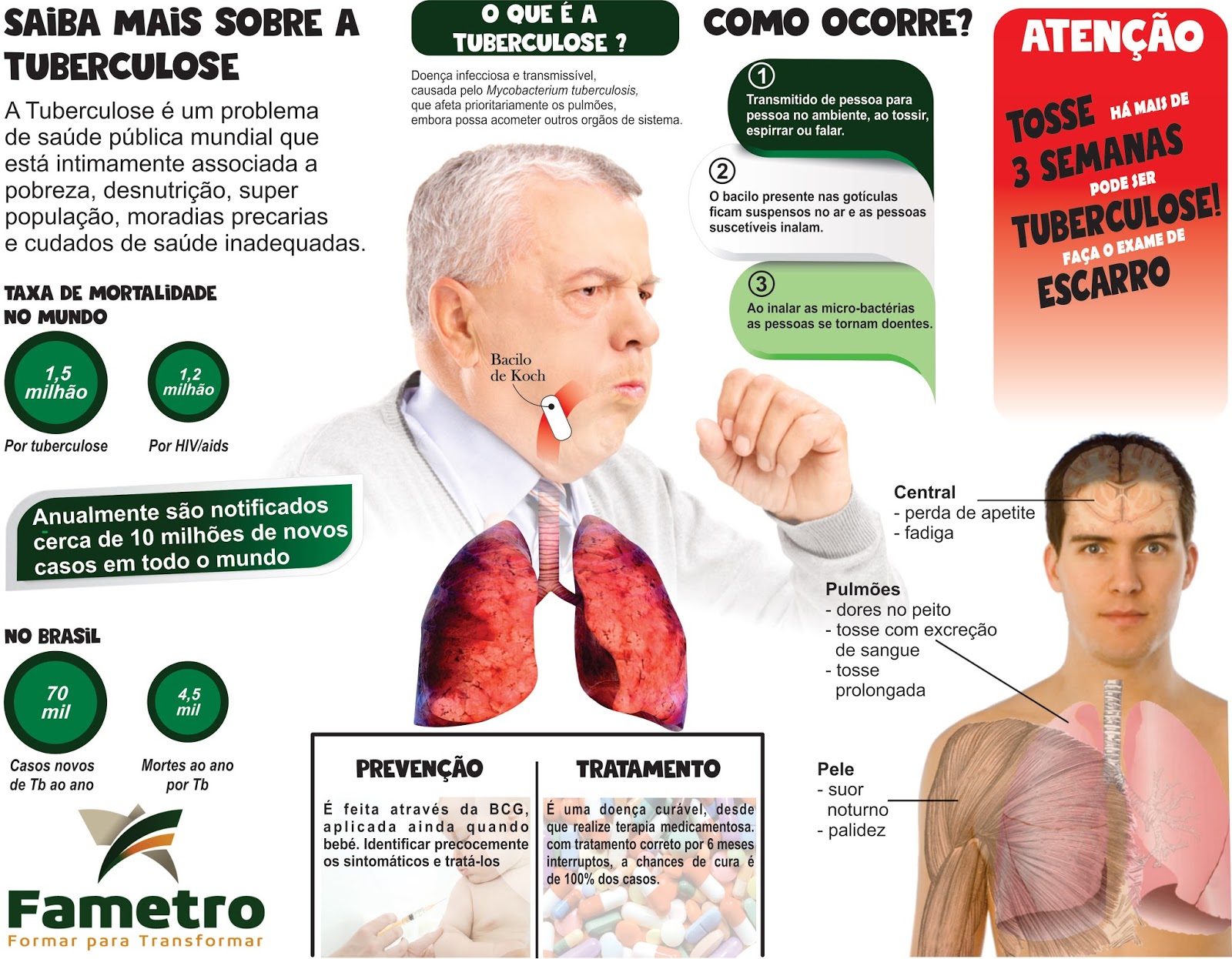 Tuberculose Pulmonaire - Tout Ce QuIl Faut Savoir Sur La Maladie - Fait