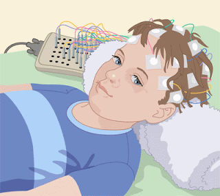 Children's Health: EEG (Electroencephalogram) | Child Healthy