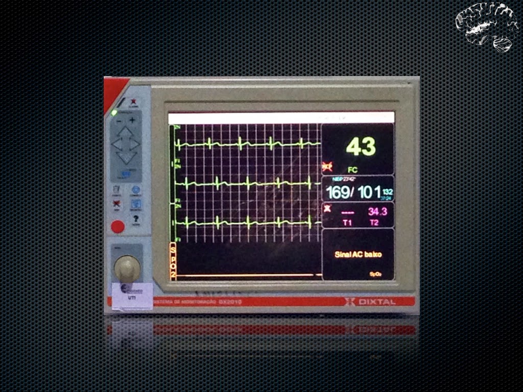 NEUROINTENSIVISMO: Tríade de Cushing: Importância dos Sinais Vitais na ...