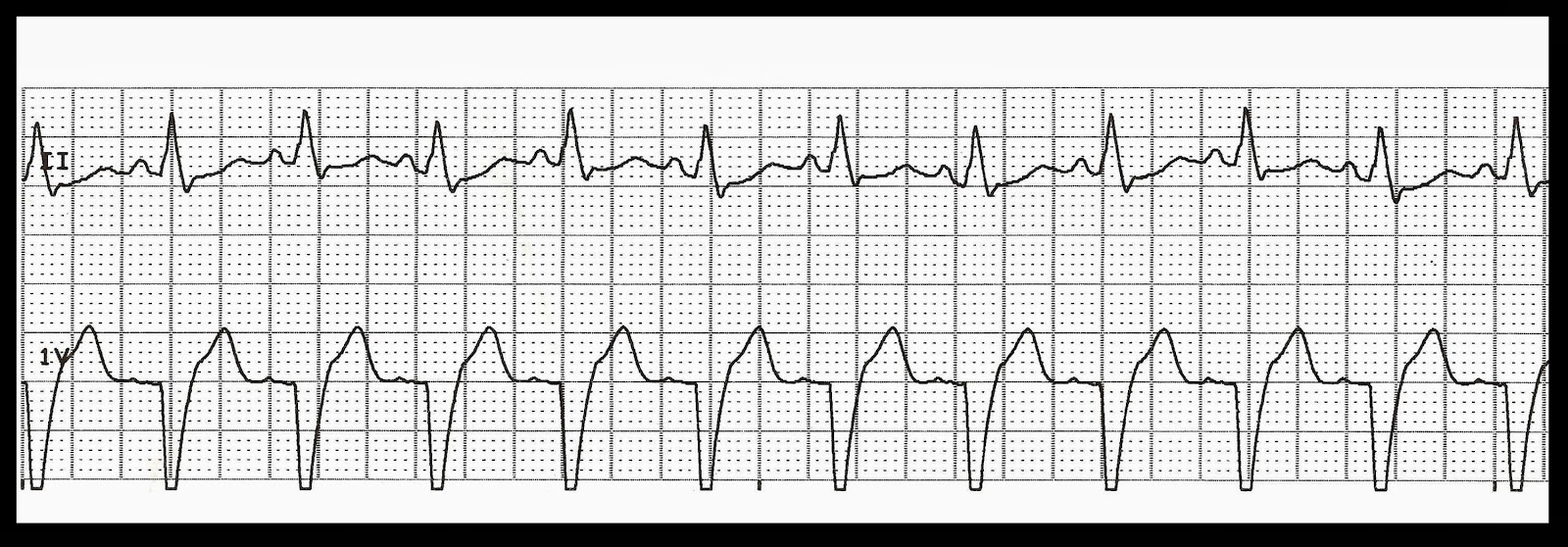 Float Nurse: February 2014