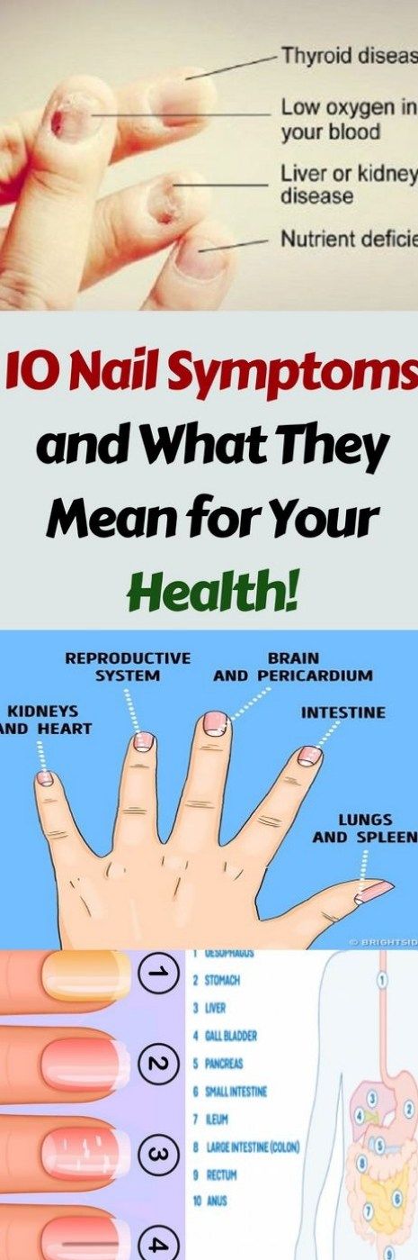 Here Are 10 Nail Symptoms & What They Mean For Your Health!!! - EXPLORE ...