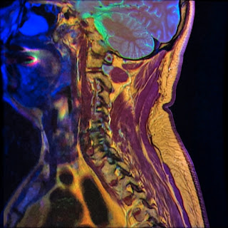 Nevit's blog: Color MRI of the Cervical verterbrae
