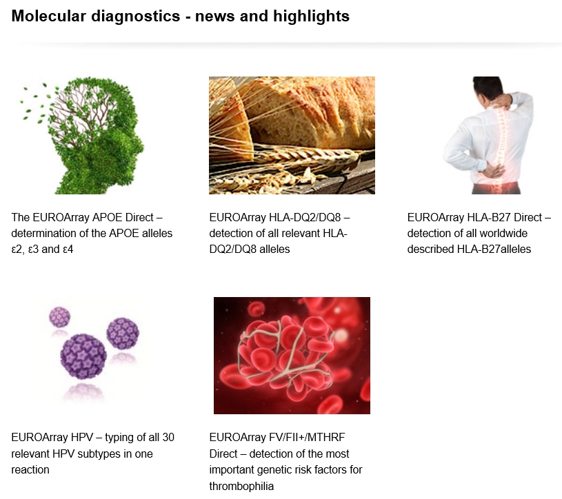 Euroimmun 한국대리점