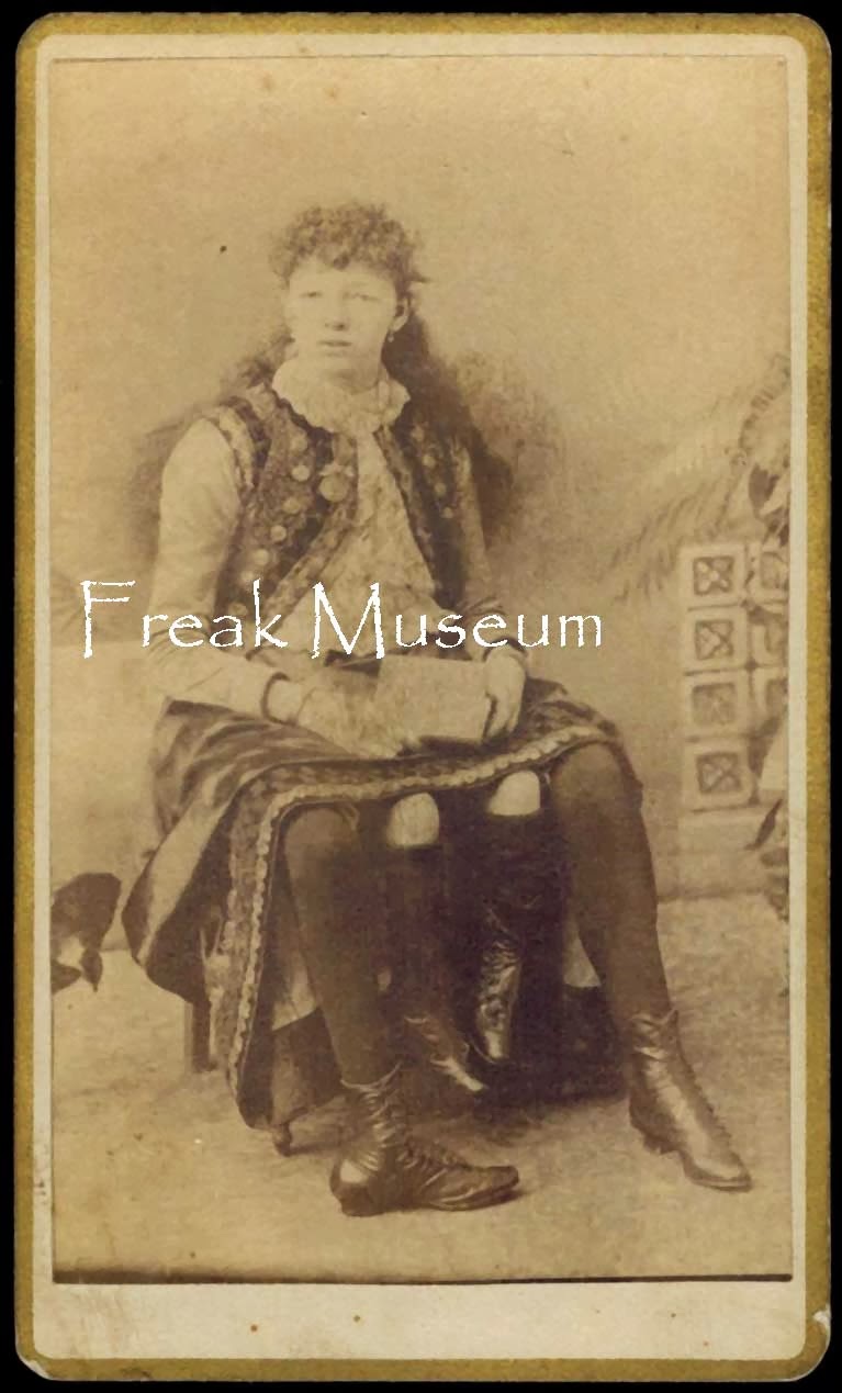 Freak Museum A Private Collection: Freak Photos 19th c.