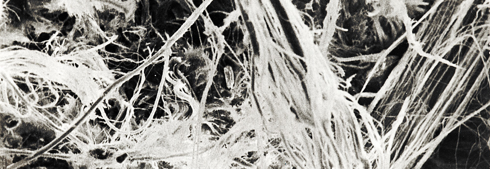 Home Story: #32: Ei unohdeta asbestia