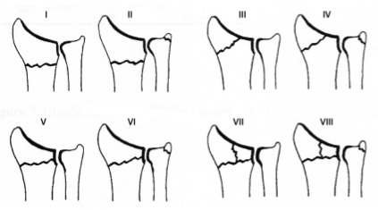 El Blog de Isa y Juan: 2018