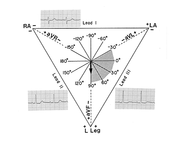 ECG: MÓDULO II DERIVAÇÕES ELETROCÁRDIOGRÁFICAS E O EIXO ELÉTRICO | MedGeek